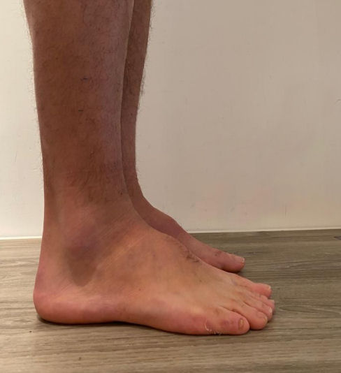 Hoe H.I.P. zijn je skischoenen? Met 'n hoge wreef of holvoet skiën